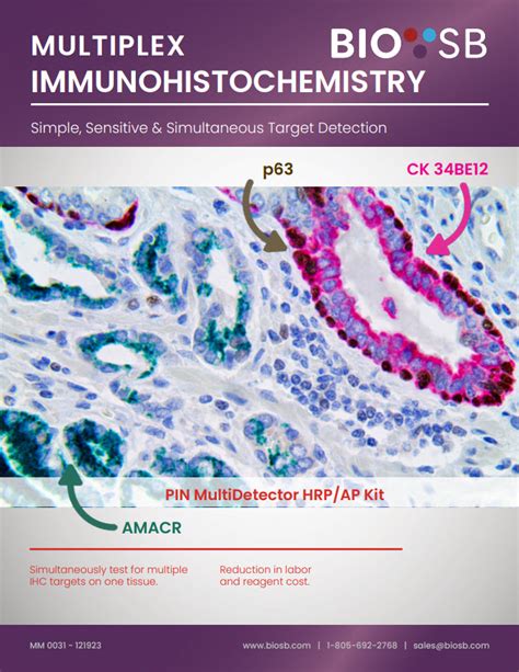 Image result for Tissue Microarray Multiplex IHC NCR