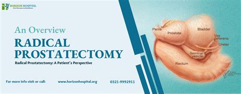 Image result for Simple vs Radical Prostatectomy