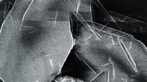 Image result for Scanning Electron Microscope Magnification