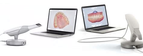 Image result for Trios Scanner