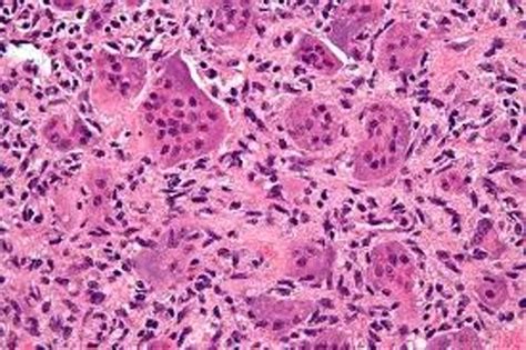 Image result for Bone Cells Function