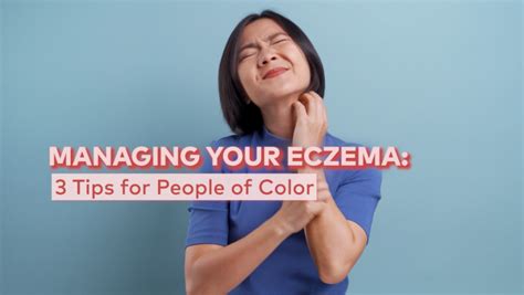 Image result for Seborrheic Dermatitis Contagious