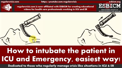 Image result for Intubate