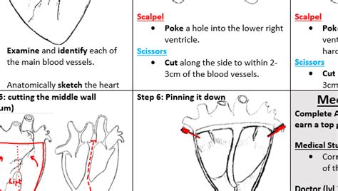 Image result for Human Heart Dissection