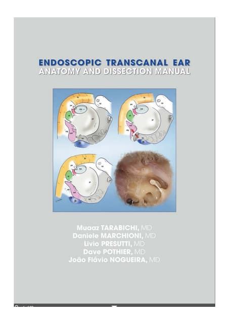 Image result for Ear Dissection