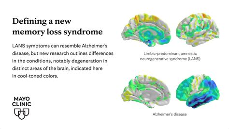 Image result for Losing Memory