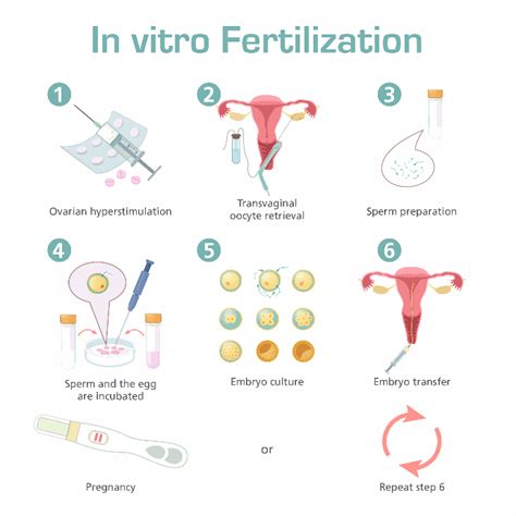 Image result for In Vitro Fertilization Procedure Step by Step