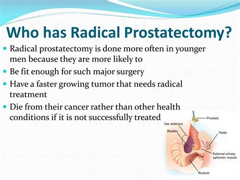 Image result for Simple vs Radical Prostatectomy