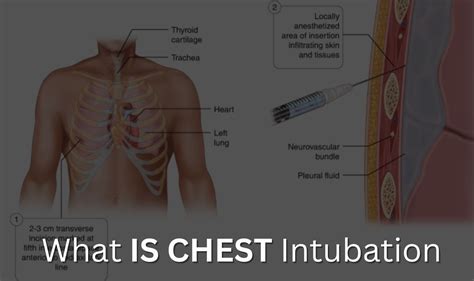 Image result for Intubation Definition