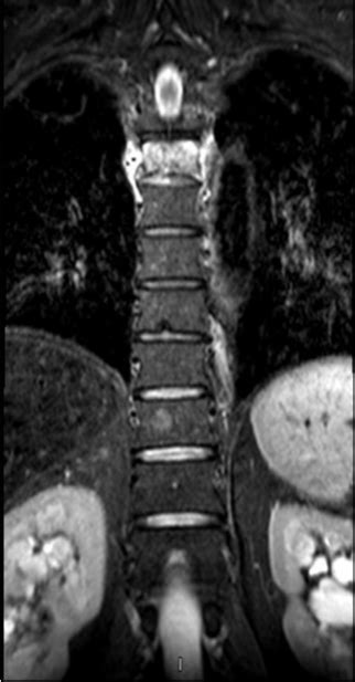 Image result for Components of MRI Real Image with Labelling