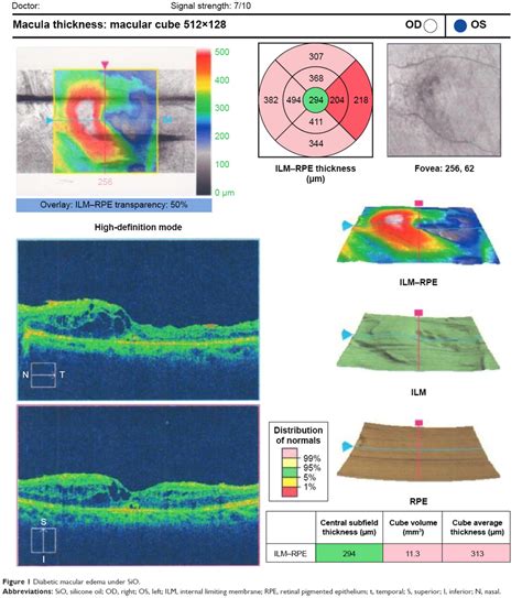 Image result for Oct Check
