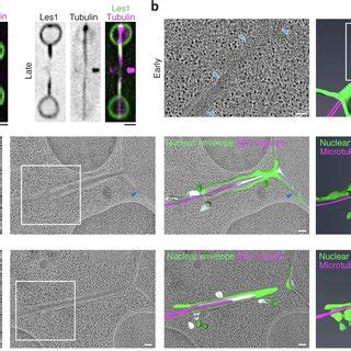 Image result for Nuclear Envelope Dissolution