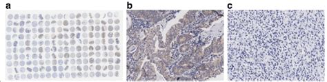 Image result for Tissue Microarray Multiplex IHC NCR