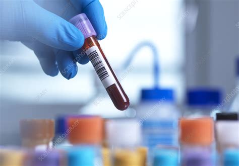 Image result for Biomedical Science Testing