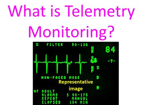 Image result for Telemetry Monitor