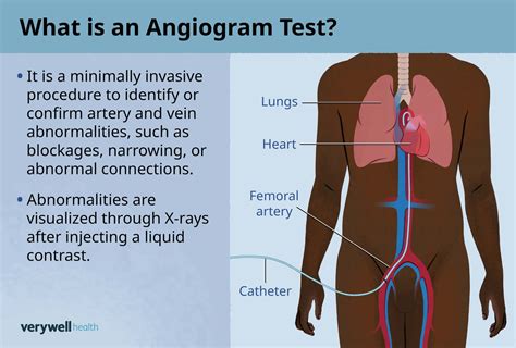 Image result for Different Types of Angiogram