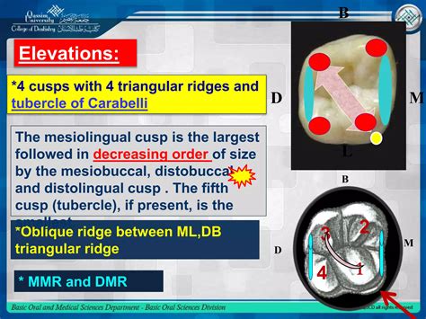Image result for Maxillary First Molar