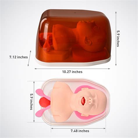 Image result for Neonatal Intubation