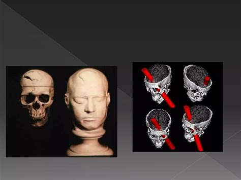 Image result for Pyramidal Tract Extrapyramidal