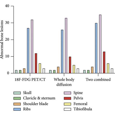 Image result for Types of Abnormal Bone Formation