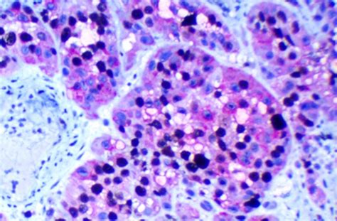 Image result for Multiplex IHC Neun