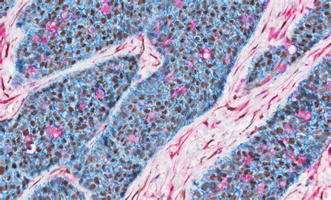 Image result for Multiplex IHC