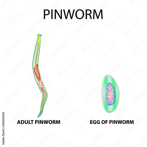 Image result for What Is Pinworm