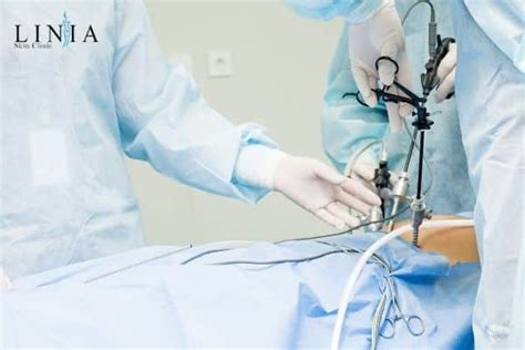 Image result for Upper-Back Cyst Surgery