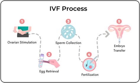 Image result for IVF Process