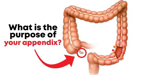 Image result for Appendix WHA Is It