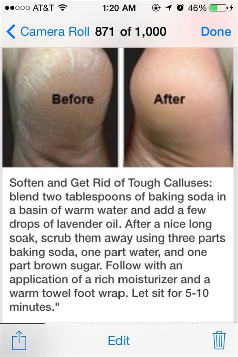 Image result for How to Remove Calluses Forever