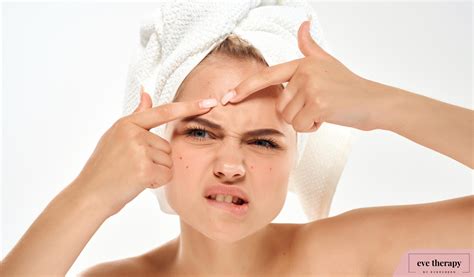 Image result for How to Avoid Pimples