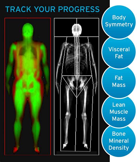 Image result for Dexa Scan Example