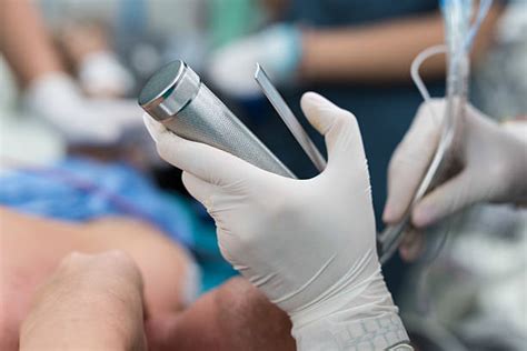 Image result for Intaocular Intubation