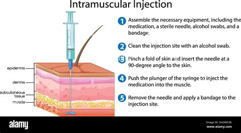 Image result for Intramuscular Injection