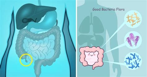 Image result for Appendix WHA Is It