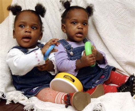 Image result for Java Island Siamese Twins