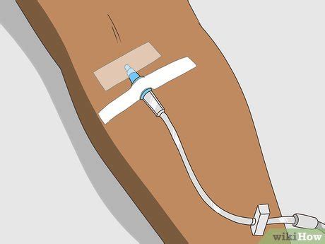 Image result for Insert IV Line