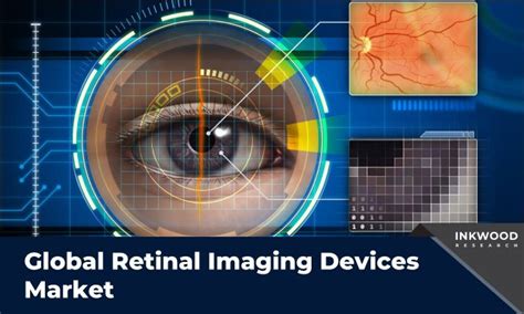 Examining the Competitive Landscape of Retinal Imaging Devices Market