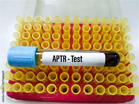Image result for Apr Tube Testing