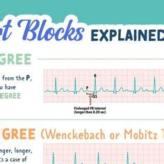 Image result for AV Block PR Interval