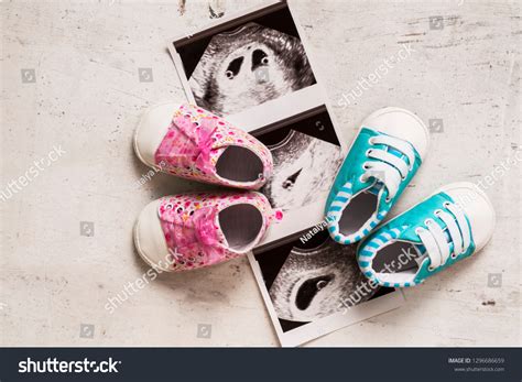 Image result for 4 Week Embryo