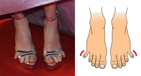 Image result for Different Types of Toes