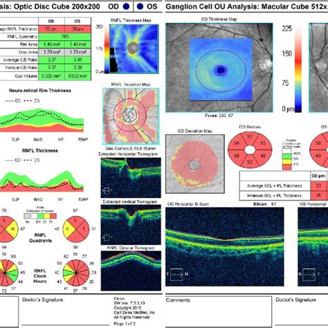 Image result for Oct Check
