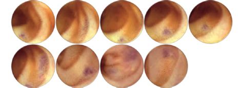 Image result for Difference Between Manual and Auto Summarization