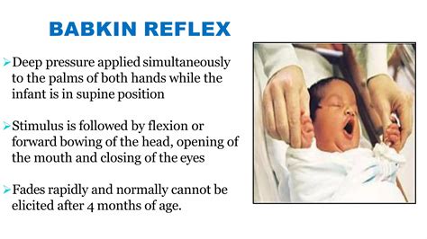 Image result for Neonatal Primitive Reflexes