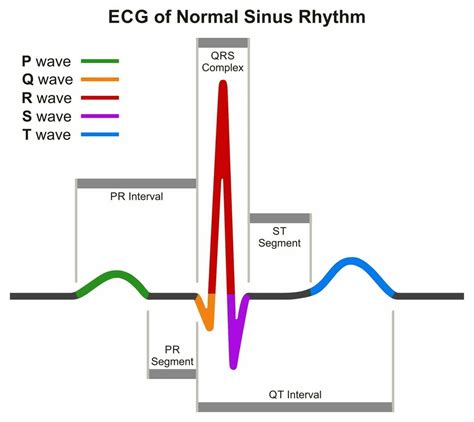 Image result for PR Interval Duration Normal