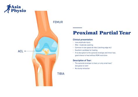 Image result for Involution Meaning