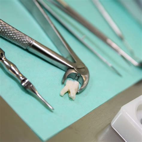 Image result for How to Remove My Tooth