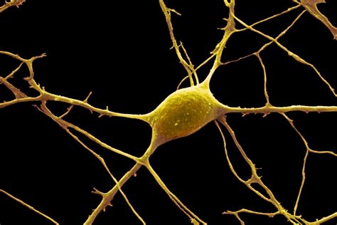 Image result for Central Neuron System